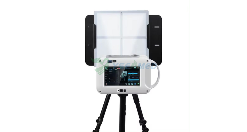 Energía de bolsillo: cómo las máquinas de rayos X portátiles están ...