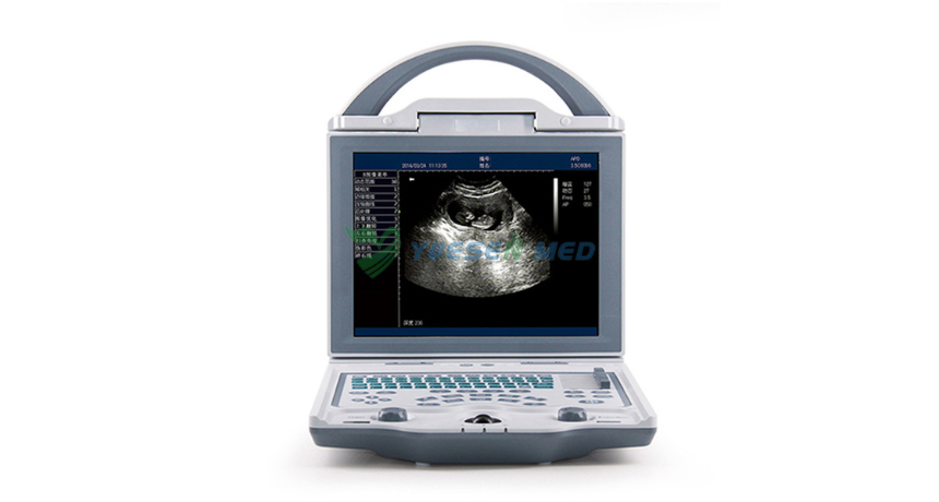 Why This Portable Ultrasound Machine Feels Like a Clinic You Can Carry ...