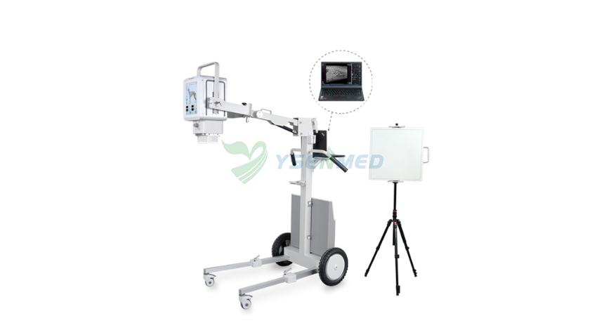 Need Speed and Precision? Meet the 5.6kW Digital Portable X-ray Unit ...